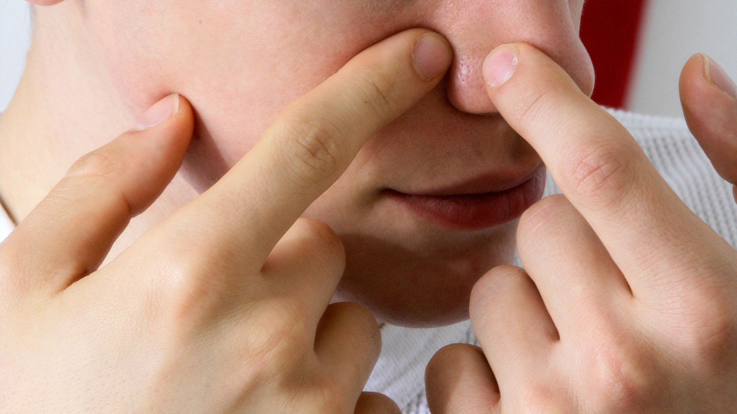 Popping Blackheads and Whiteheads - Pros and Cons | DIY Cosmetics